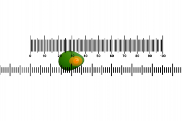 Using the ocular scale and microscopy microscopy | ROQED