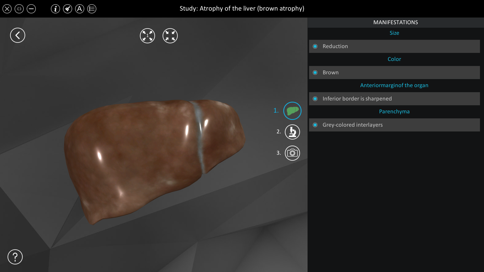 Atrophy of the liver (brown atrophy) | ROQED